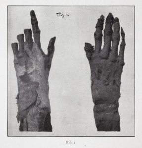 Rylands BlogBefore the body-snatchers; the early anatomists and ...